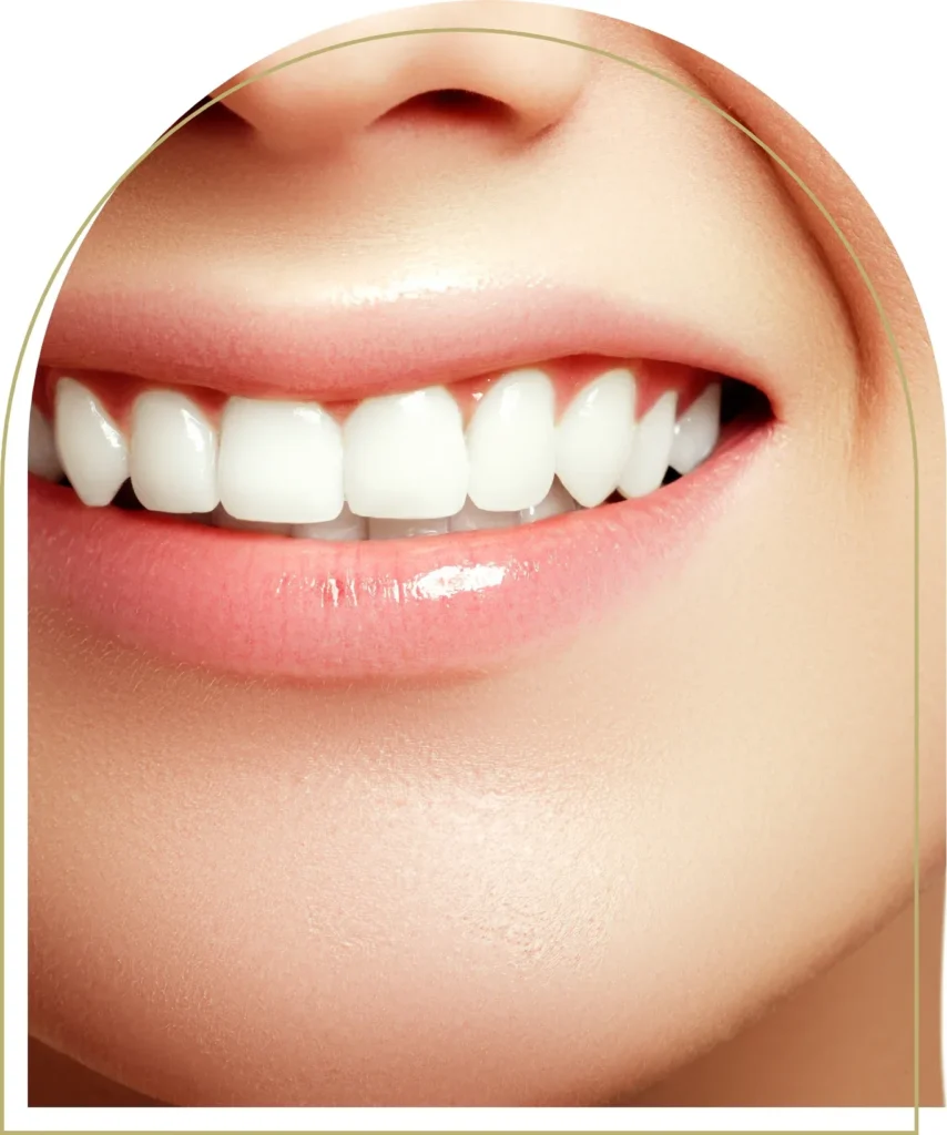 Tooth Fillings - Advanced Dental Care Mosman